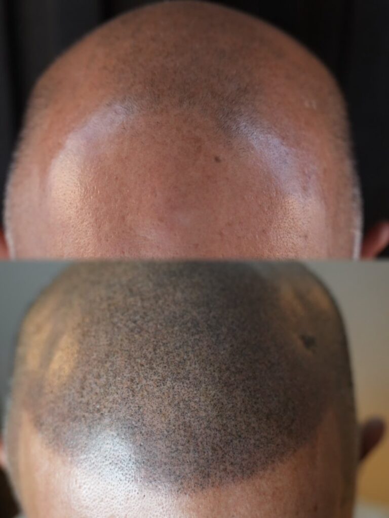 ABOUT – THE SCALP INKオフィシャルサイト